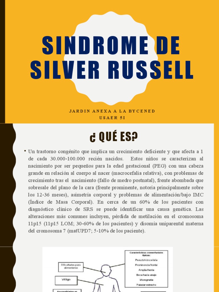Silver Russell | PDF | Escoliosis | Apnea