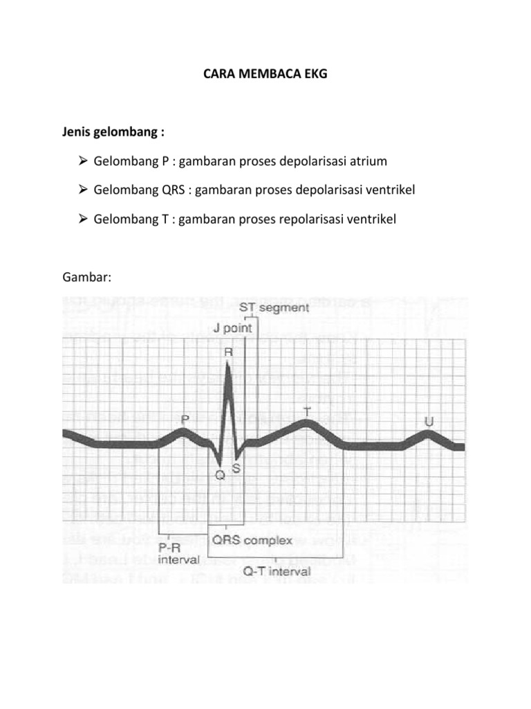 Panduan Membaca EKG untuk Pemula | PDF | Sains & Matematika