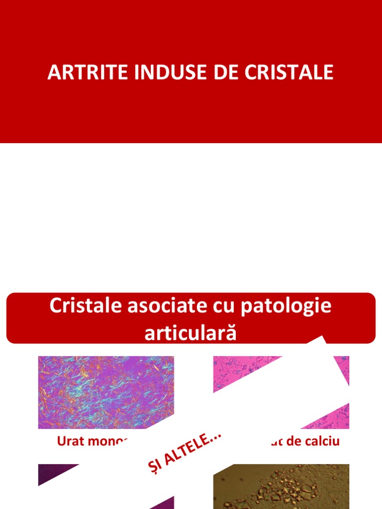 Artrite Induse de Cristale | PDF