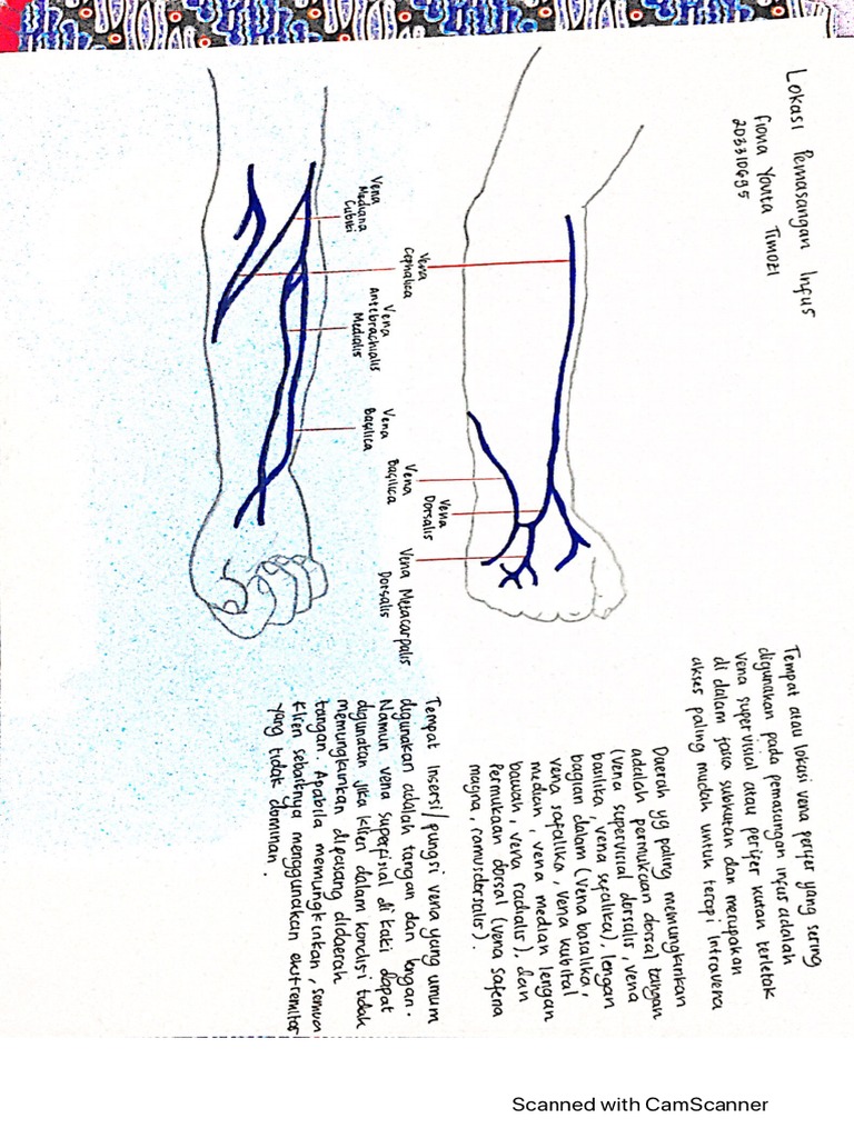 Fiona Yovita Timozi 203310695 Tugas Gambar Lokasi Pemasangan Infus | PDF