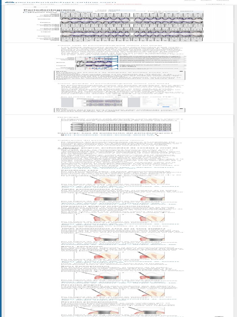 Periodontal Chart Online - WWW - Perio-Tools - Com 2 | PDF | Archivo de ...