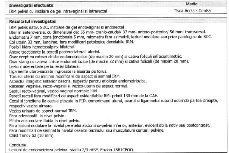 RMN Endometrioza | PDF