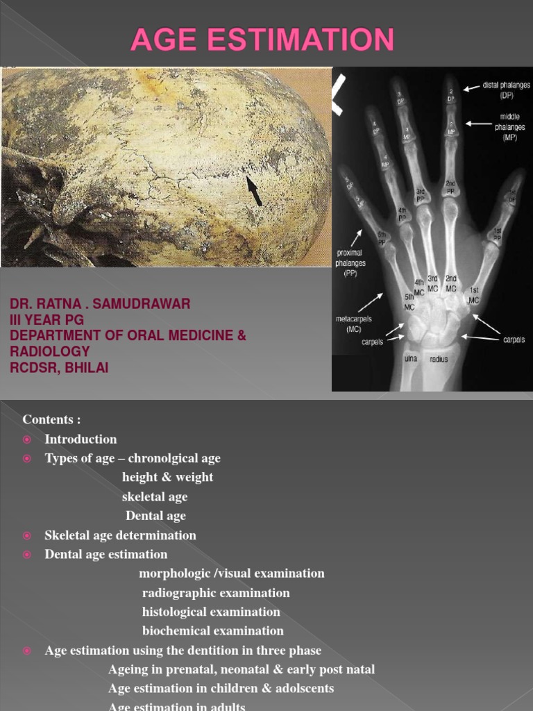 Age Estimation | PDF | Skull | Human Tooth