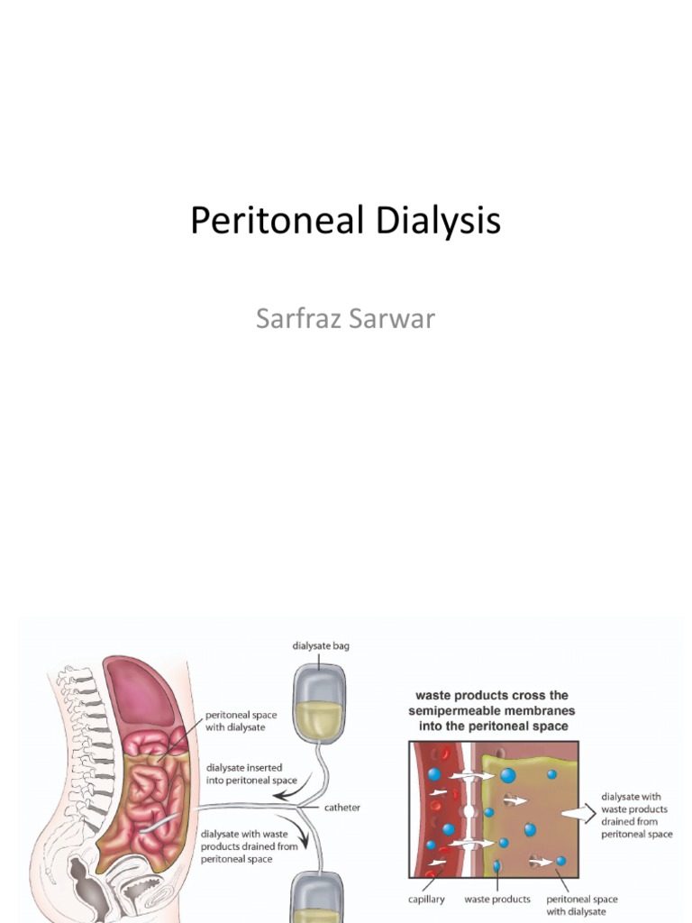 Peritoneal Dialysis | PDF