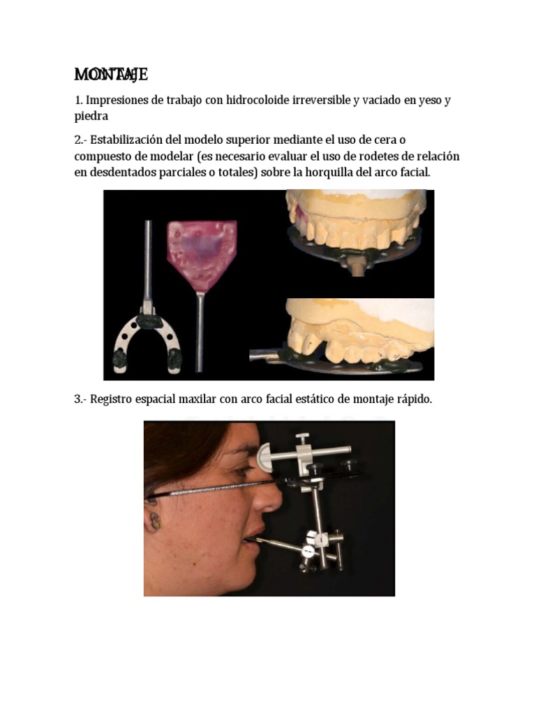 Montaje Articulador | PDF