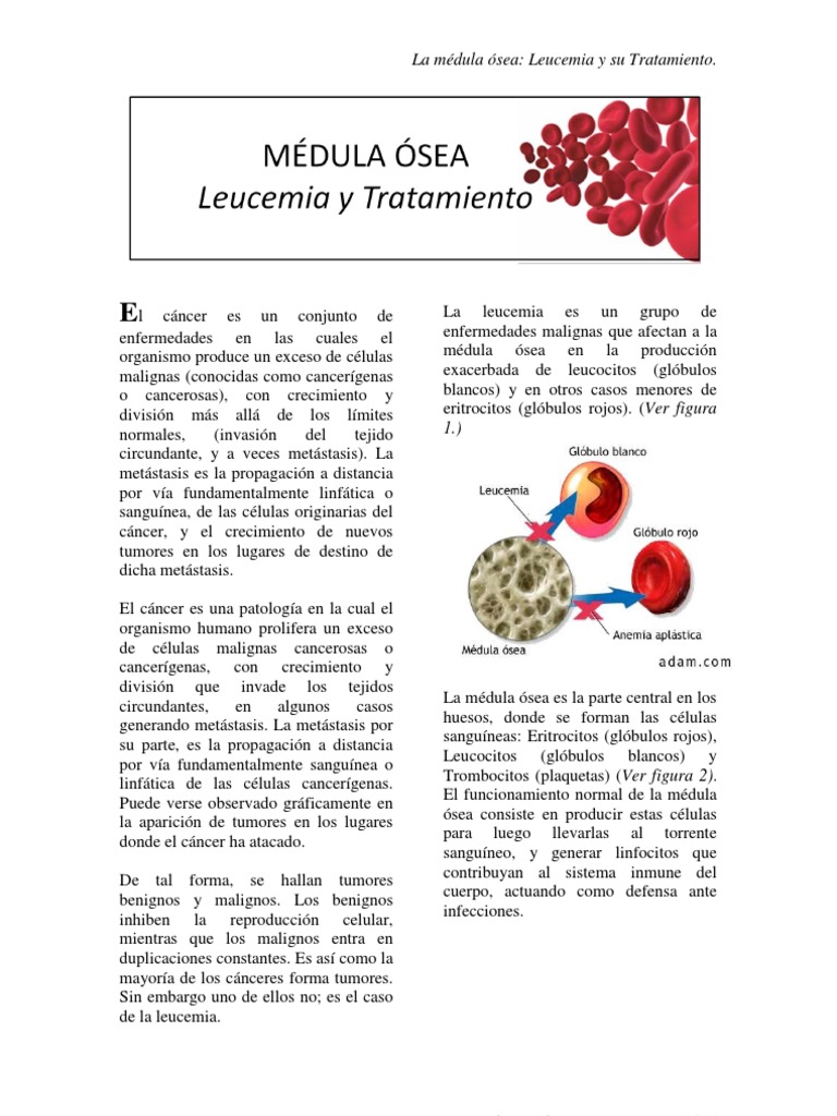 Leucemia Paper | Descargar gratis PDF | Leucemia | Leucocito