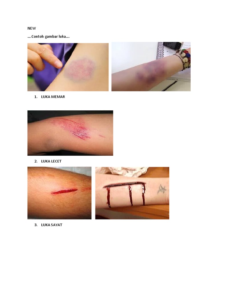 Contoh Gambar Luka.... NEW | PDF