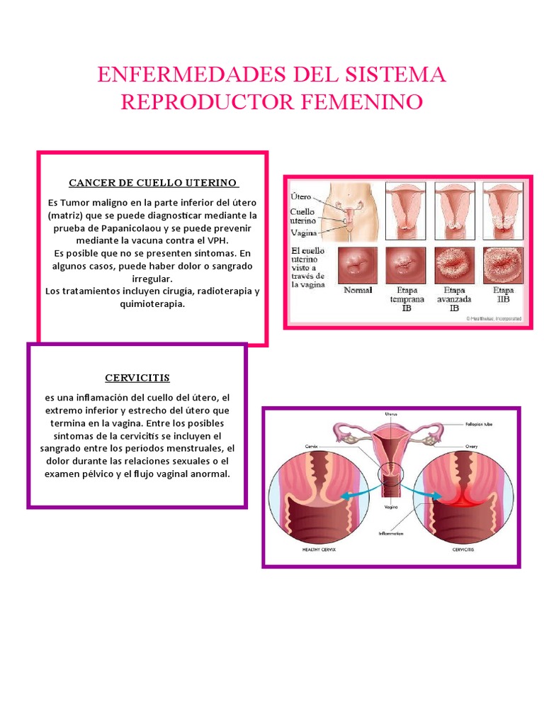 Enfermedades Del Sistema Reproductor Femenino y Masculino | PDF