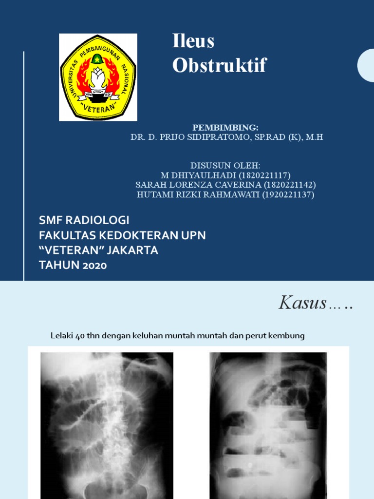 Ada Yang Diganti-Illeus Obstruksi | PDF