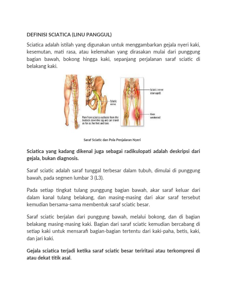 SCIATICA | PDF | Sains & Matematika