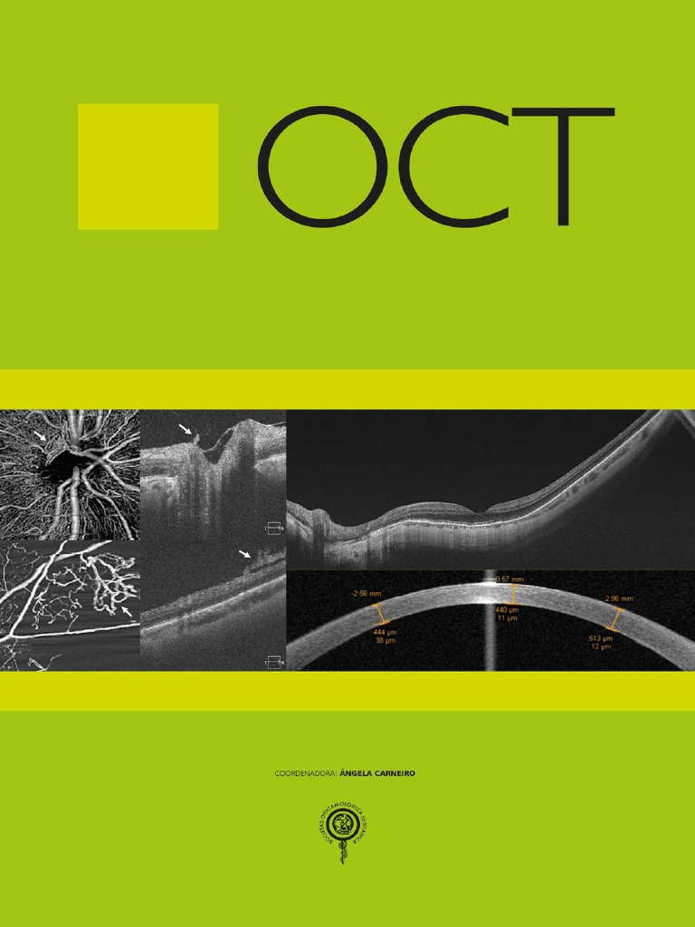 Livro OCT | PDF | Portugal | Espelho