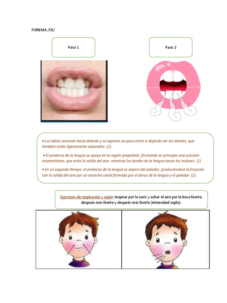 Articulación del Fonema /Ch/ | PDF