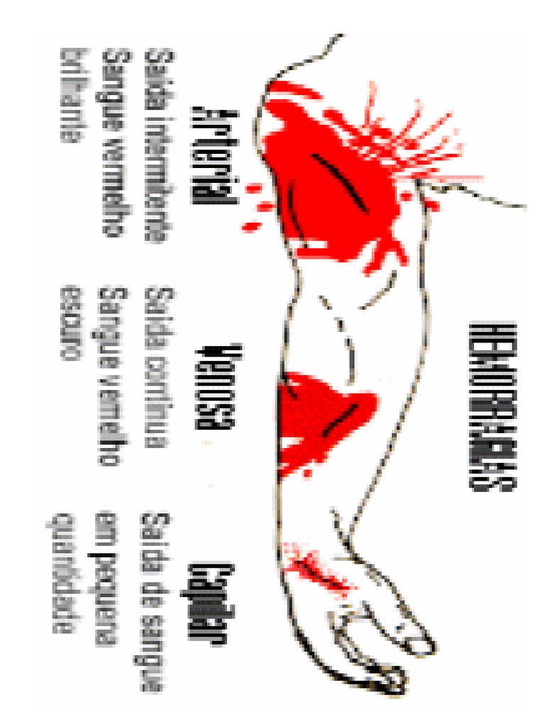 Hemorragias | PDF | Sangramento | Artéria