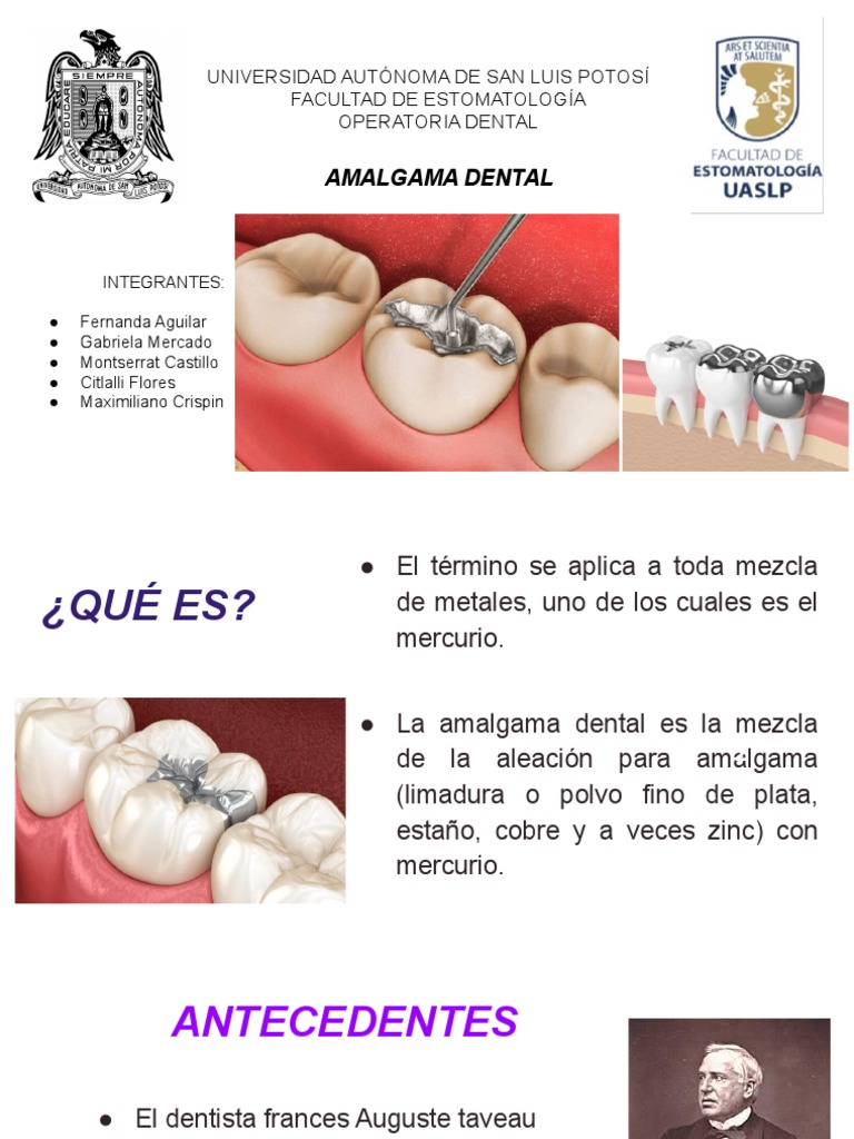 Amalgamas | PDF | Cobre | Mercurio (Elemento)