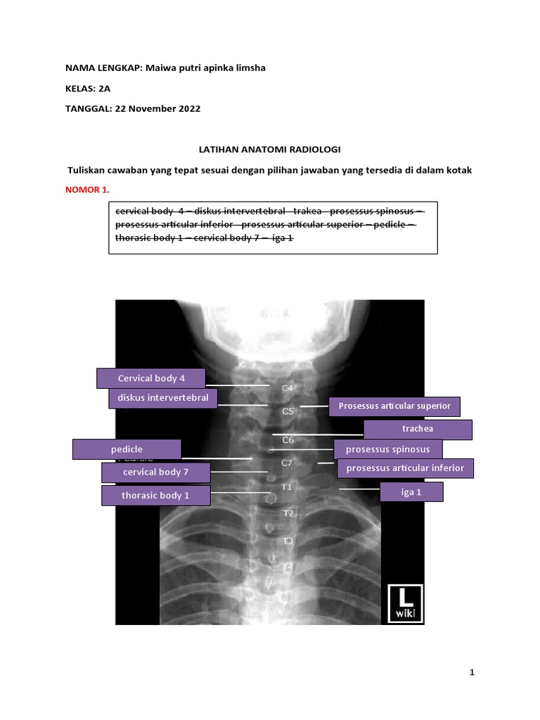 Anatomi Radiologi Vertebrae | PDF