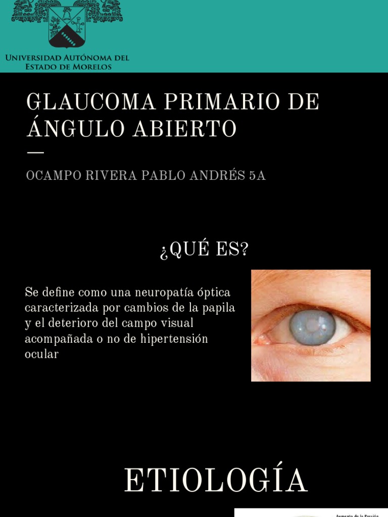 Glaucoma Primario de Angulo Abierto | PDF | Glaucoma | Percepción visual