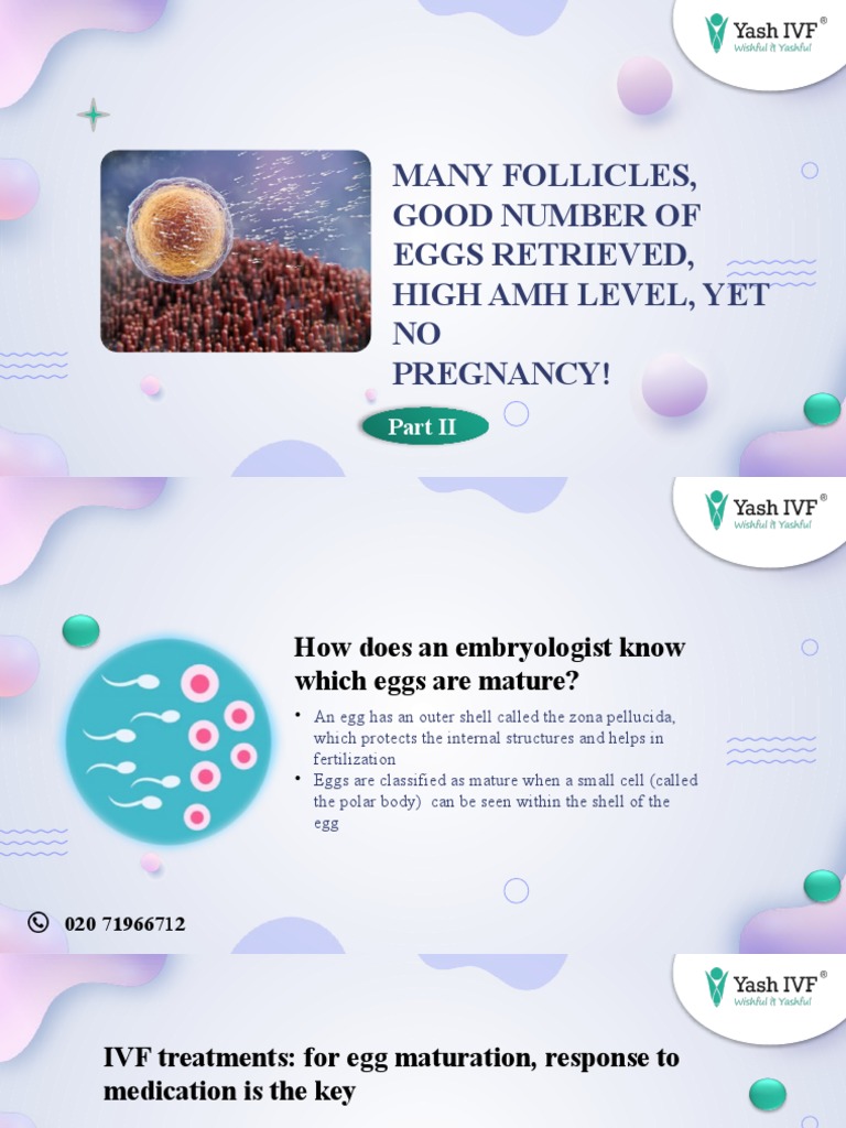 Part2 Many Follicles, Good Number of Eggs Retrieved | PDF | Polycystic ...