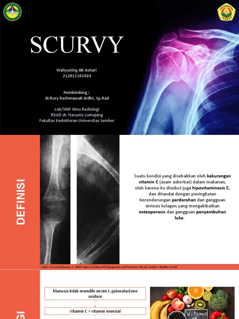 Scurvy - Wahyuning Ati Ashari | PDF