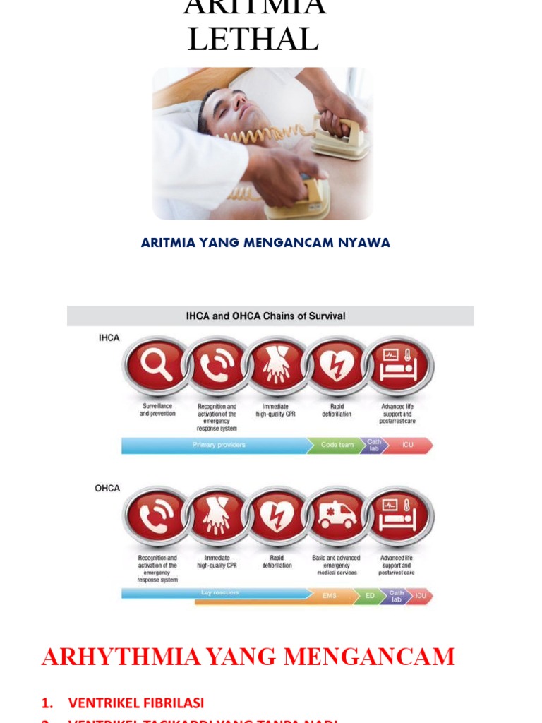 Aritmia Lethal | PDF