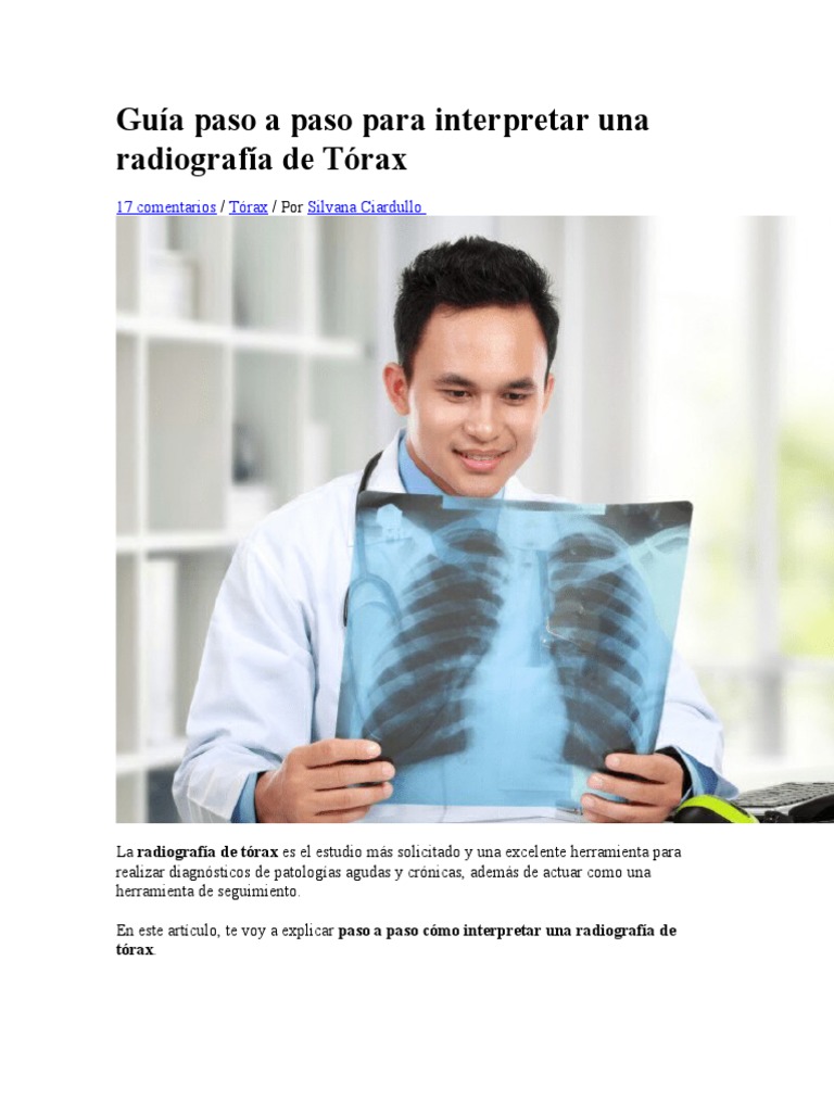 Guía Paso A Paso para Interpretar Una Radiografía de Tórax-1 | PDF | Pulmón | Tórax
