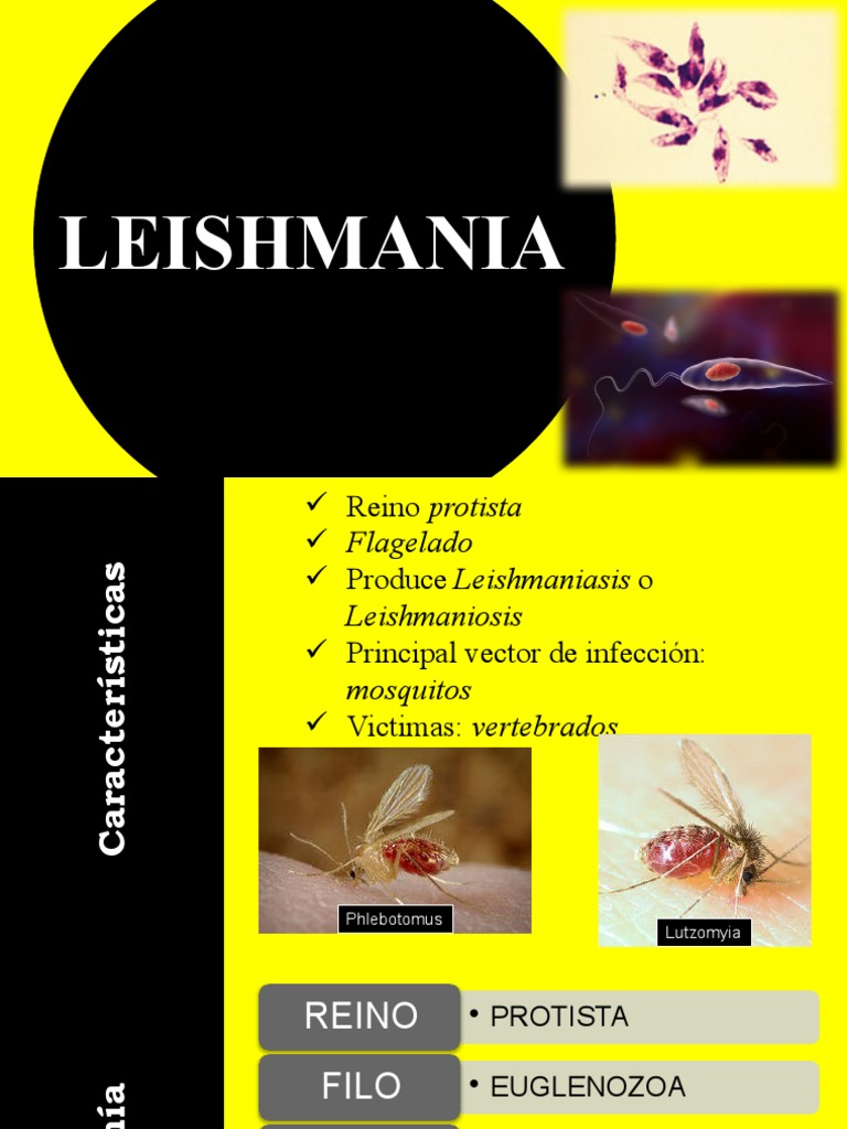 LEISHMANIASIS | PDF | Especialidades Medicas | Medicina CLINICA