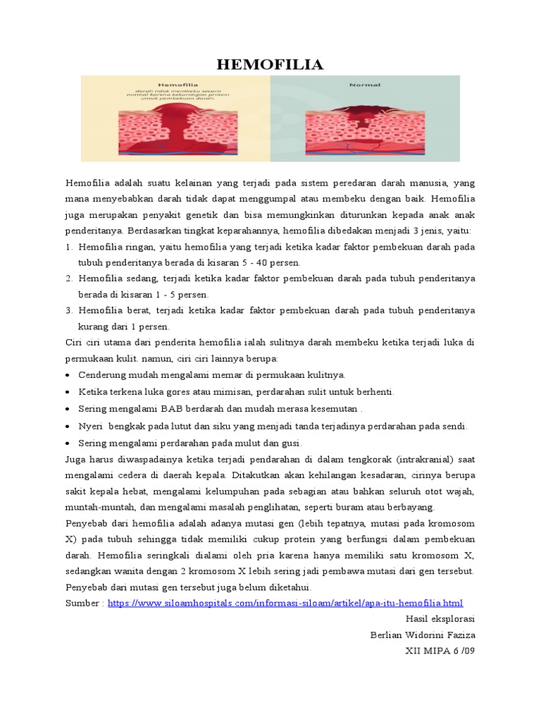 HEMOFILIA | PDF