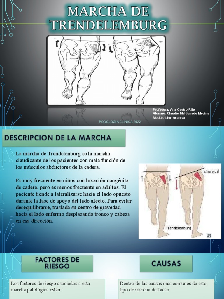 Marcha de Trendelemburg | PDF