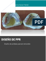 Línea de Fulcro en Prótesis Removible | PDF | Dentadura postiza ...