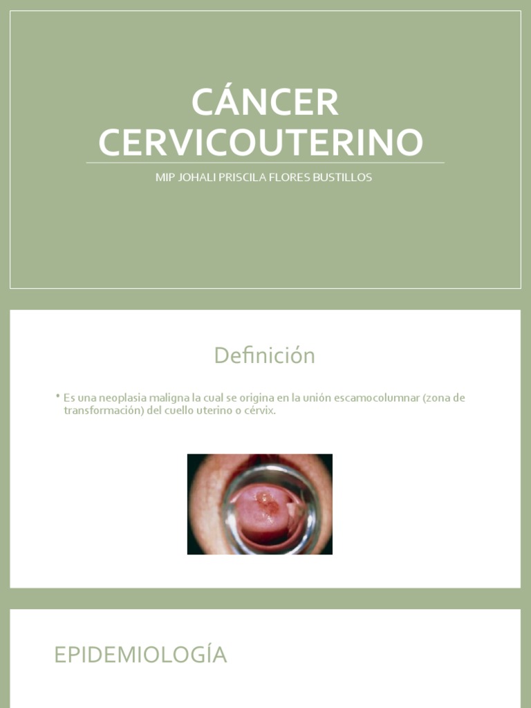 Cancer Cervicouterino | PDF | Cáncer | Especialidades Medicas