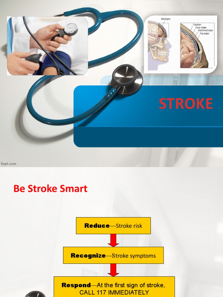 Stroke Lecture | PDF | Stroke | Medicine