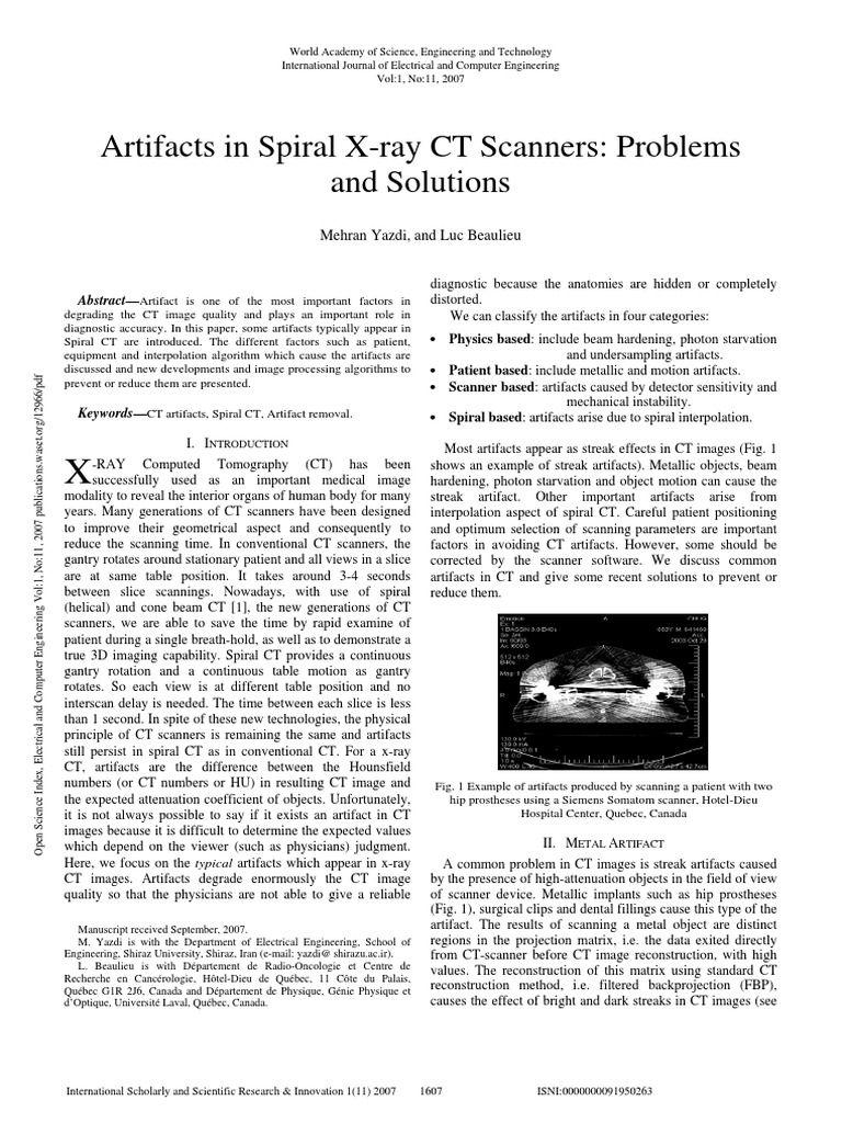 Spiral CT Artifacts: Causes and Solutions | PDF | Ct Scan | Image Scanner