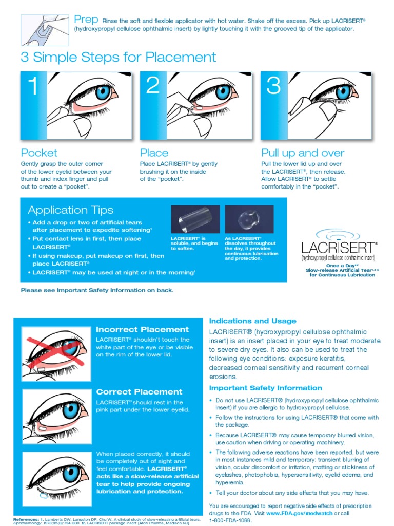 Lacrisert Patient Instructions | PDF | Clinical Medicine | Medical ...
