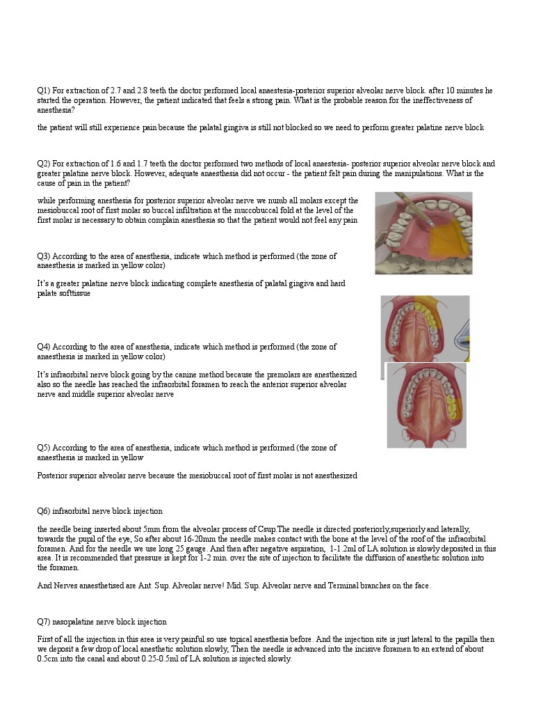Local anesthesia techniques for dental extractions | PDF | Mouth ...