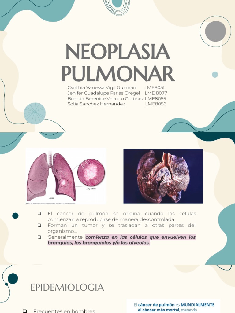 Neoplasia Pulmonar | PDF | Cáncer de pulmón | Cáncer
