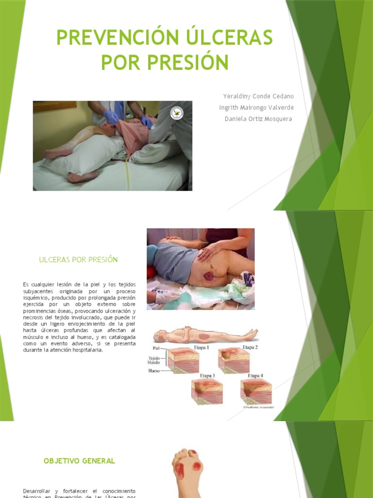 Prevención Úlceras Por Presión | PDF | Ciencias de la Salud | Causas de la muerte