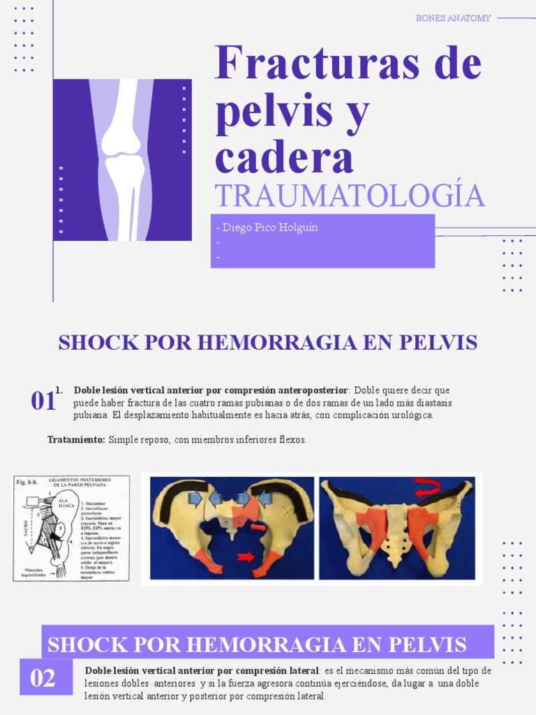 Fracturas de pelvis y cadera: clasificaciones, mecanismos, signos y ...