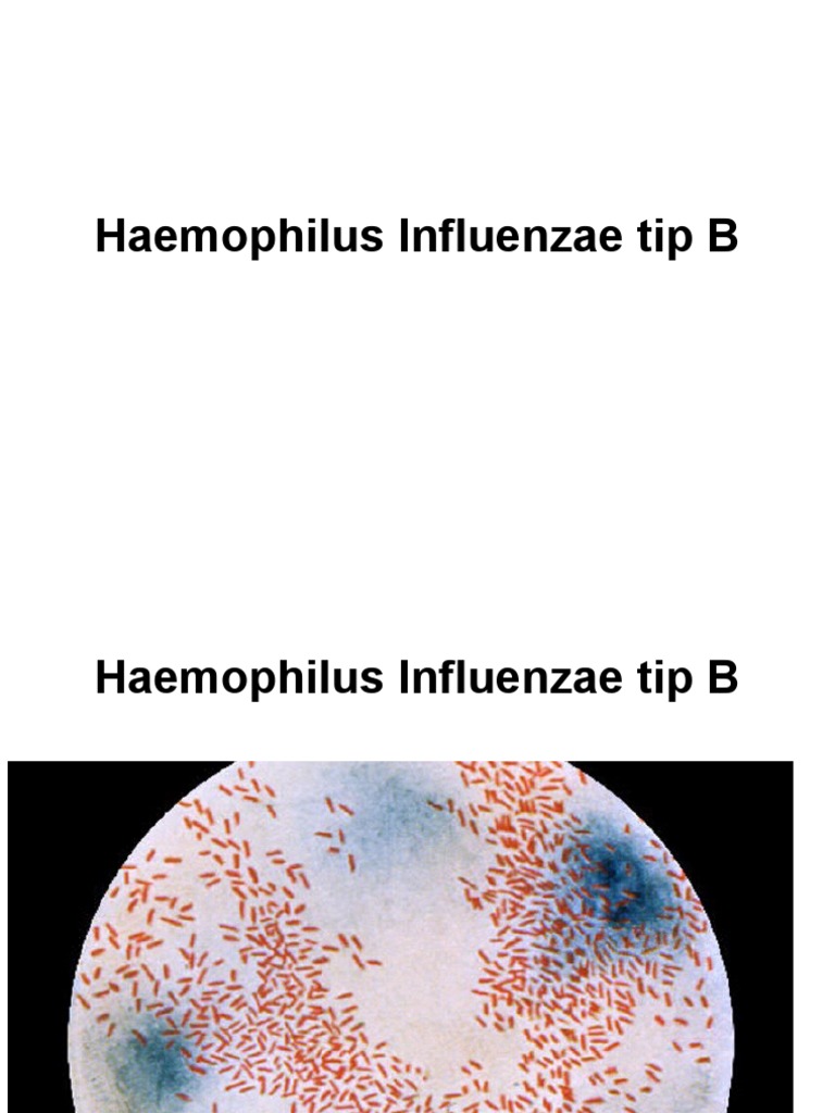Haemophilus Influenzae, Pneumococ, Meningococ R | PDF
