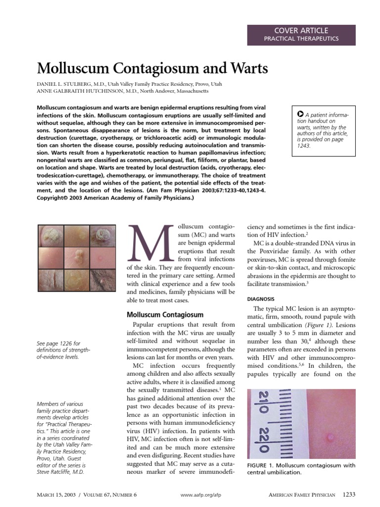 Molluscum Contagiosum and Warts | Medicine | Medical Specialties