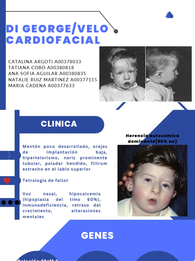 Análisis del Síndrome de DiGeorge/Velo-Cardio-Facial mediante técnicas ...