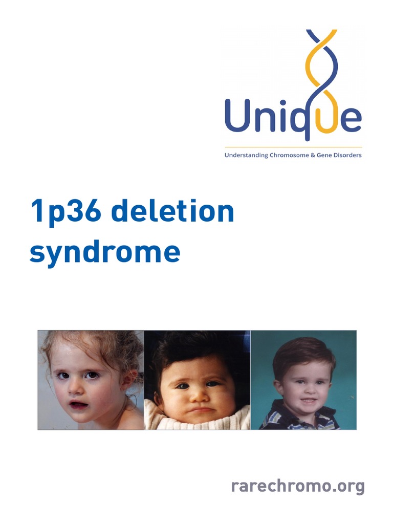 1p36 Deletions FTNW | PDF | Congenital Heart Defect | Ventricle (Heart)