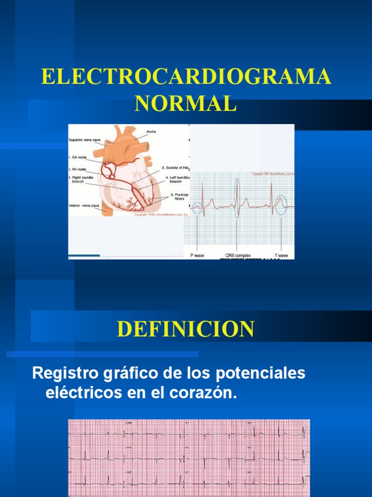 Electrocardiograma Normal | PDF | Electrocardiografia | Sistema cardiovascular