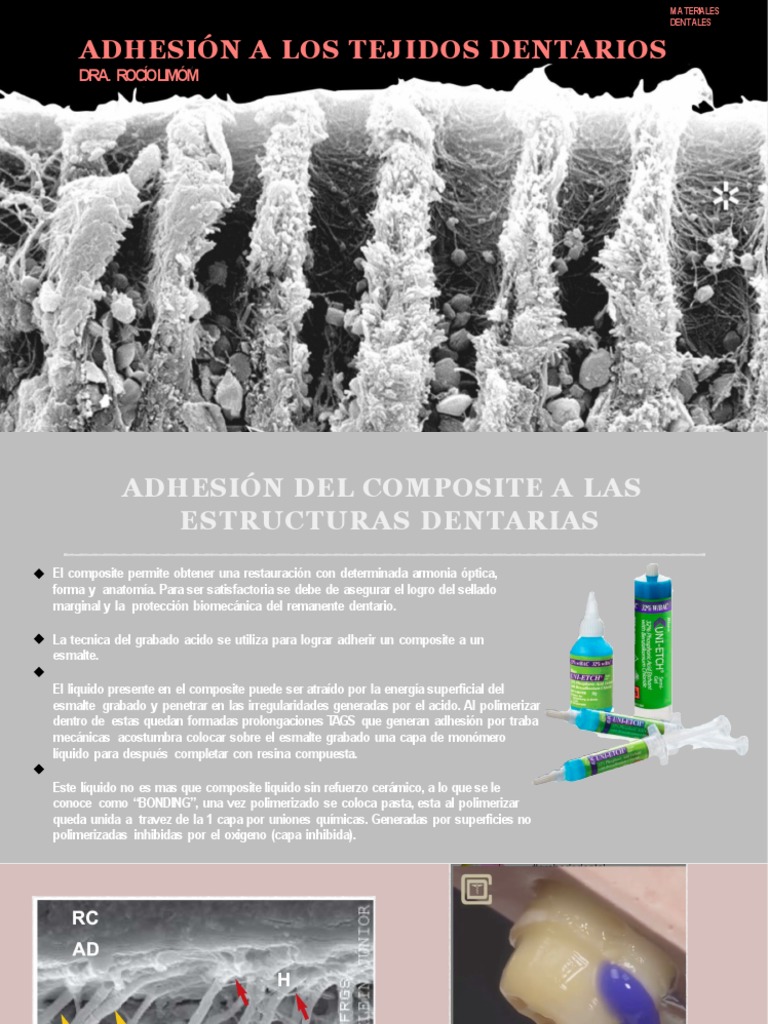 Adhesión A Los Tejidos Dentarios | PDF | Compuesto Dental | Adhesión
