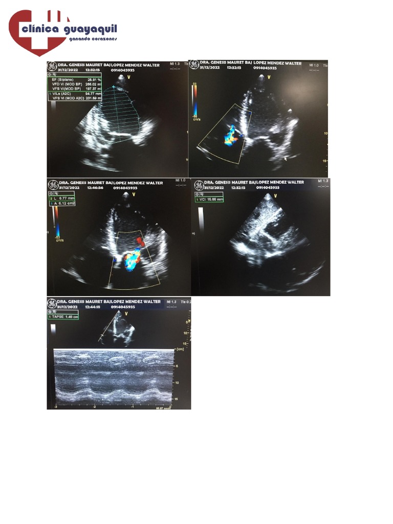 Informe Doppler | PDF
