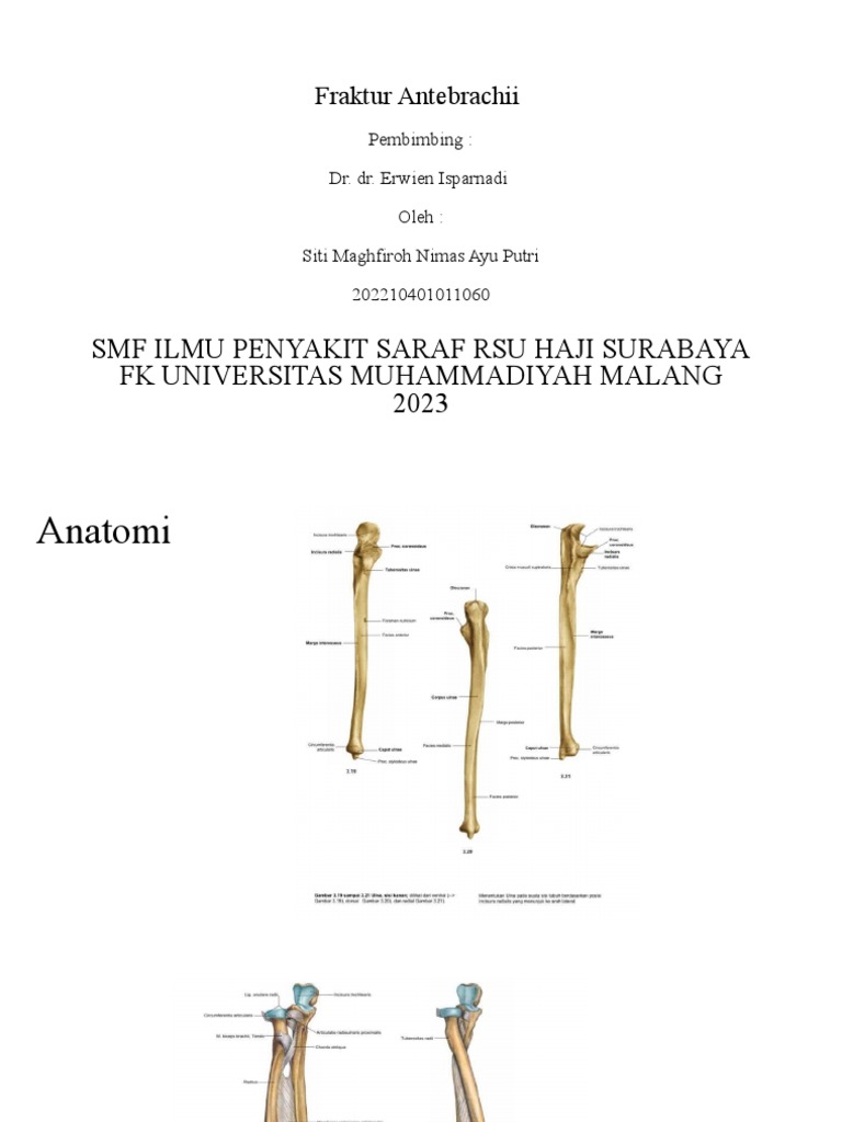 Fraktur Antebrachii: Tinjauan Anatomi dan Jenis-jenis Fraktur pada ...