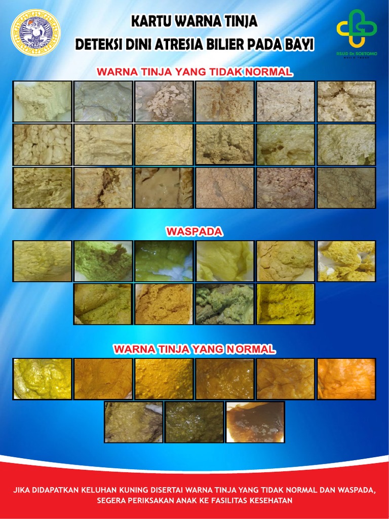 Kartu Warna Tinja Siph | PDF