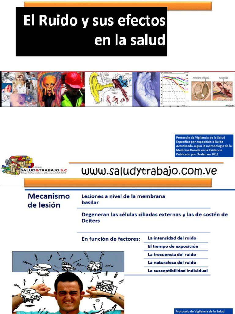 Clase Iv Daños A La Salud Por Exposición A Ruido | PDF