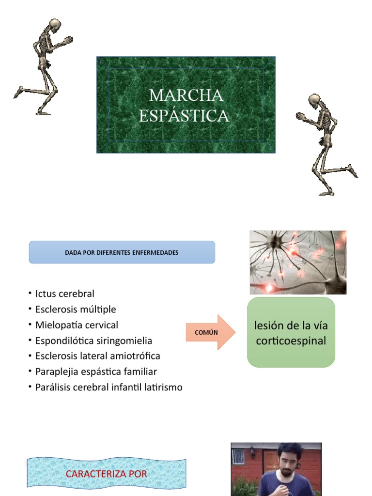 Marcha Espastica y Senil | PDF