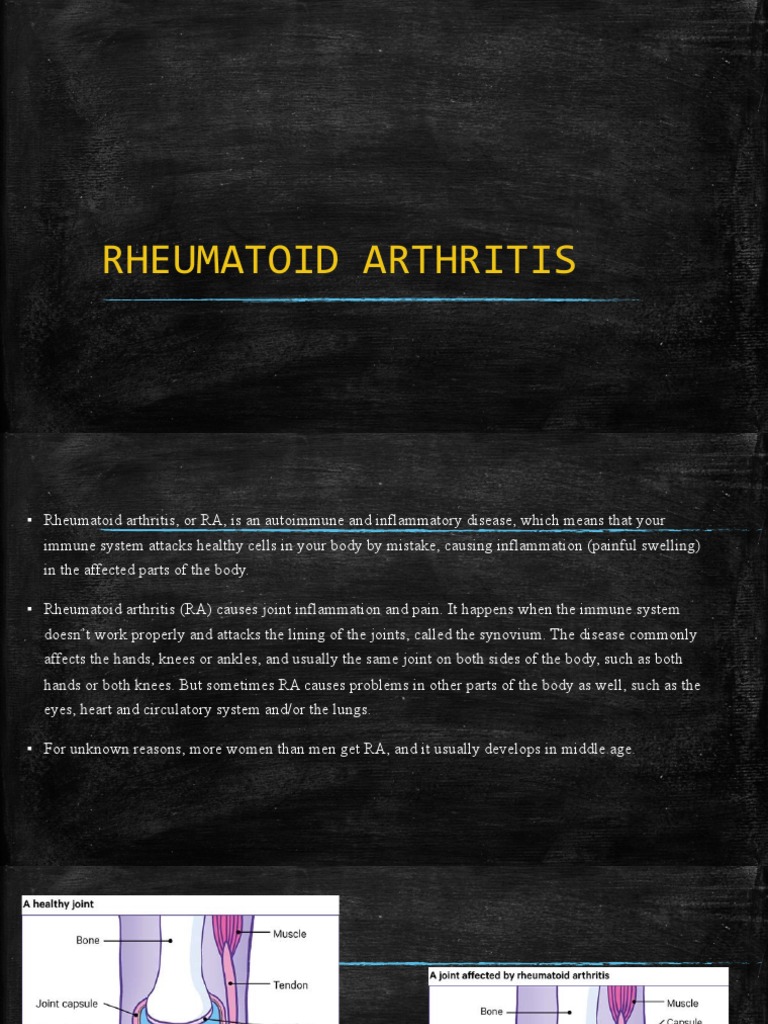 Rheumatoid Arthritis | PDF | Rheumatoid Arthritis | Arthritis