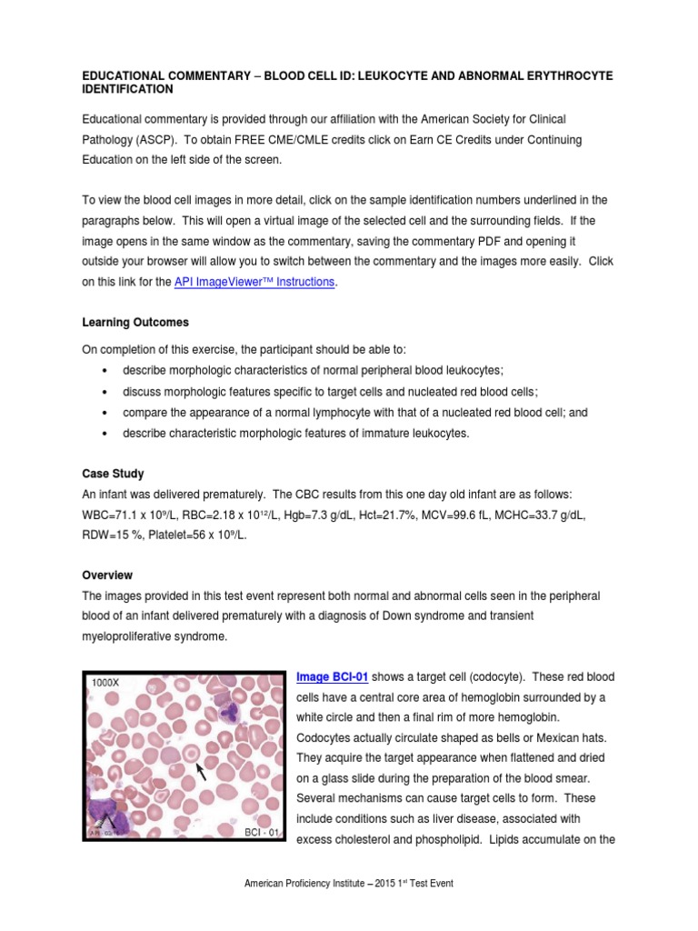 Educational Commentary - Blood Cell Id Leukocyte and Abnormal ...