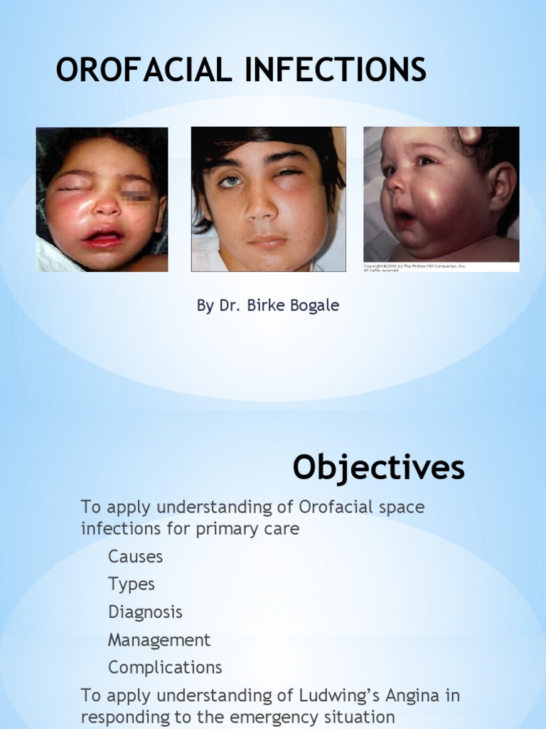 3.orofacial Infections | PDF | Medical Specialties | Clinical Medicine